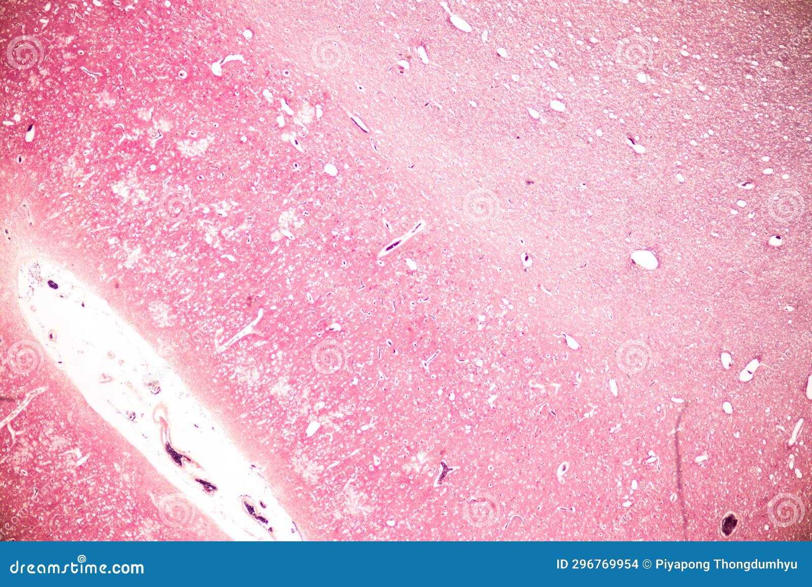 Human Nervous System Under the Microscope in Lab. Stock Photo - Image ...