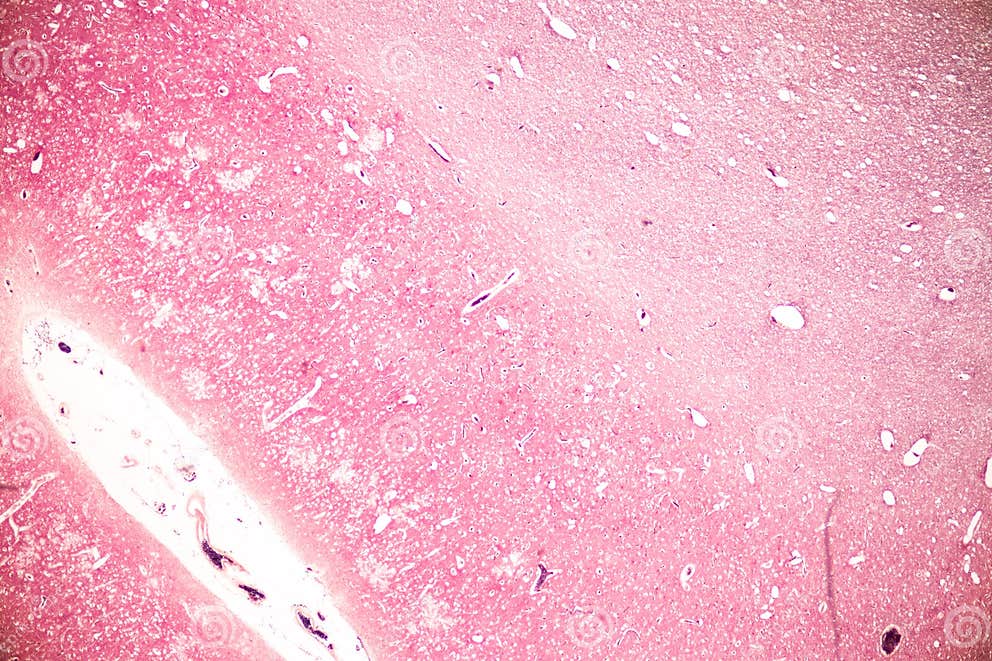 Human Nervous System Under the Microscope in Lab. Stock Photo - Image ...