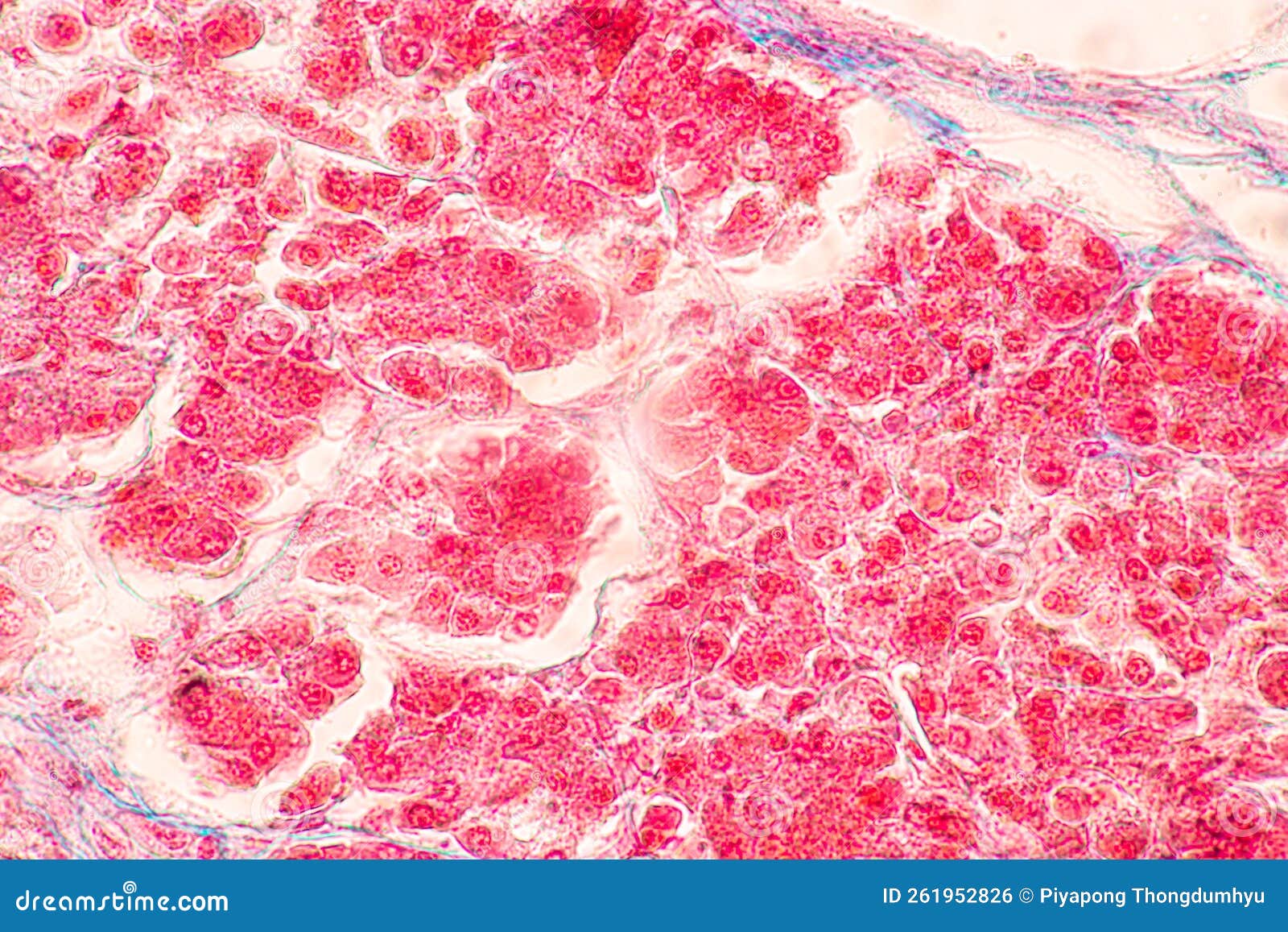 Tissue of Stomach Human, Small Intestine Human, Pancreas Human and ...