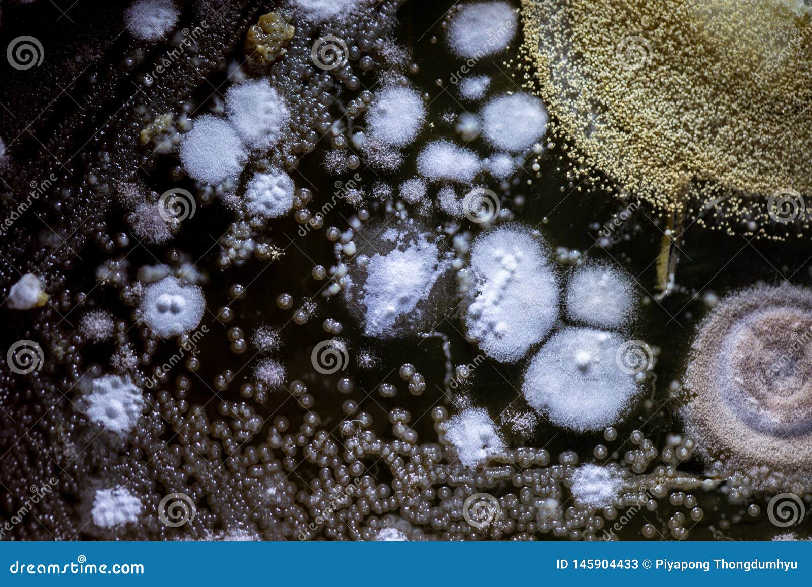 Colony Characteristics of Mold Under the Microscope. Stock Image ...