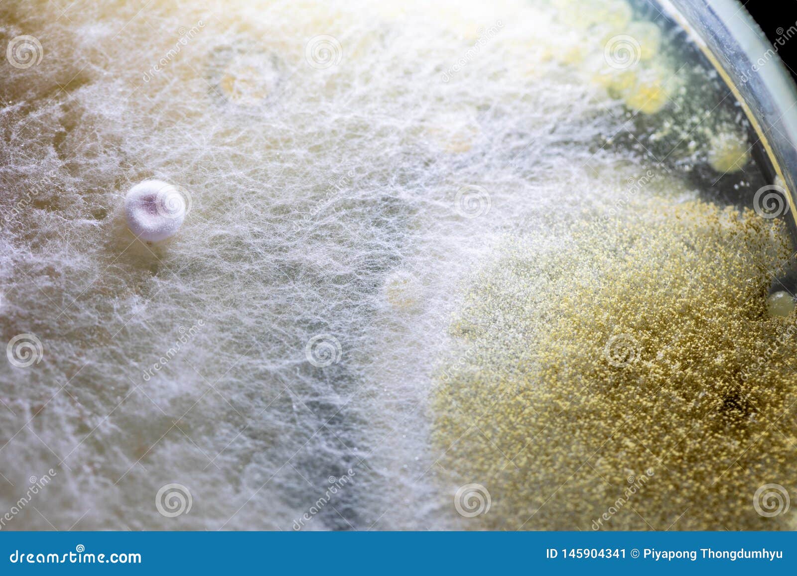Colony Characteristics of Mold Under the Microscope. Stock Image ...