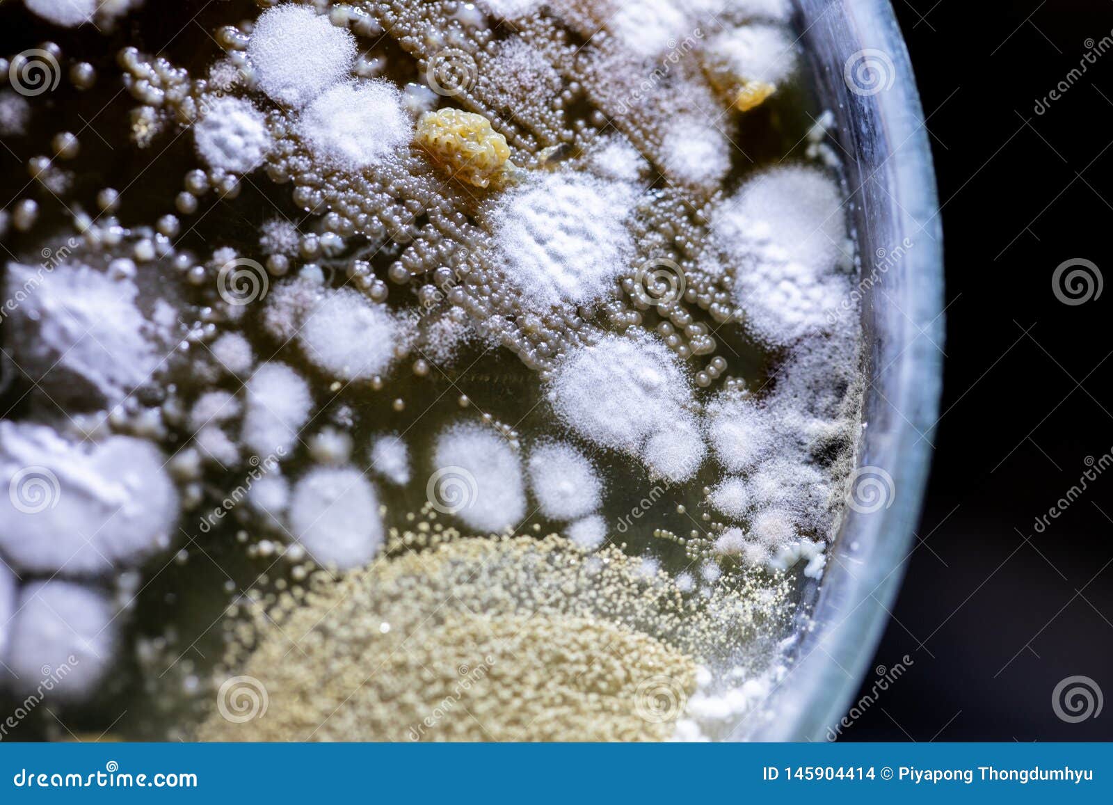 Colony Characteristics of Mold Under the Microscope. Stock Photo ...