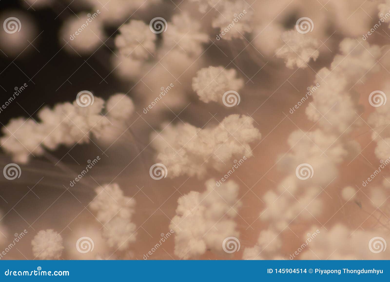 Colony Characteristics of Mold Under the Microscope. Stock Photo ...