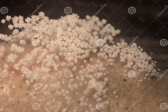 Colony Characteristics of Mold Under the Microscope. Stock Photo ...