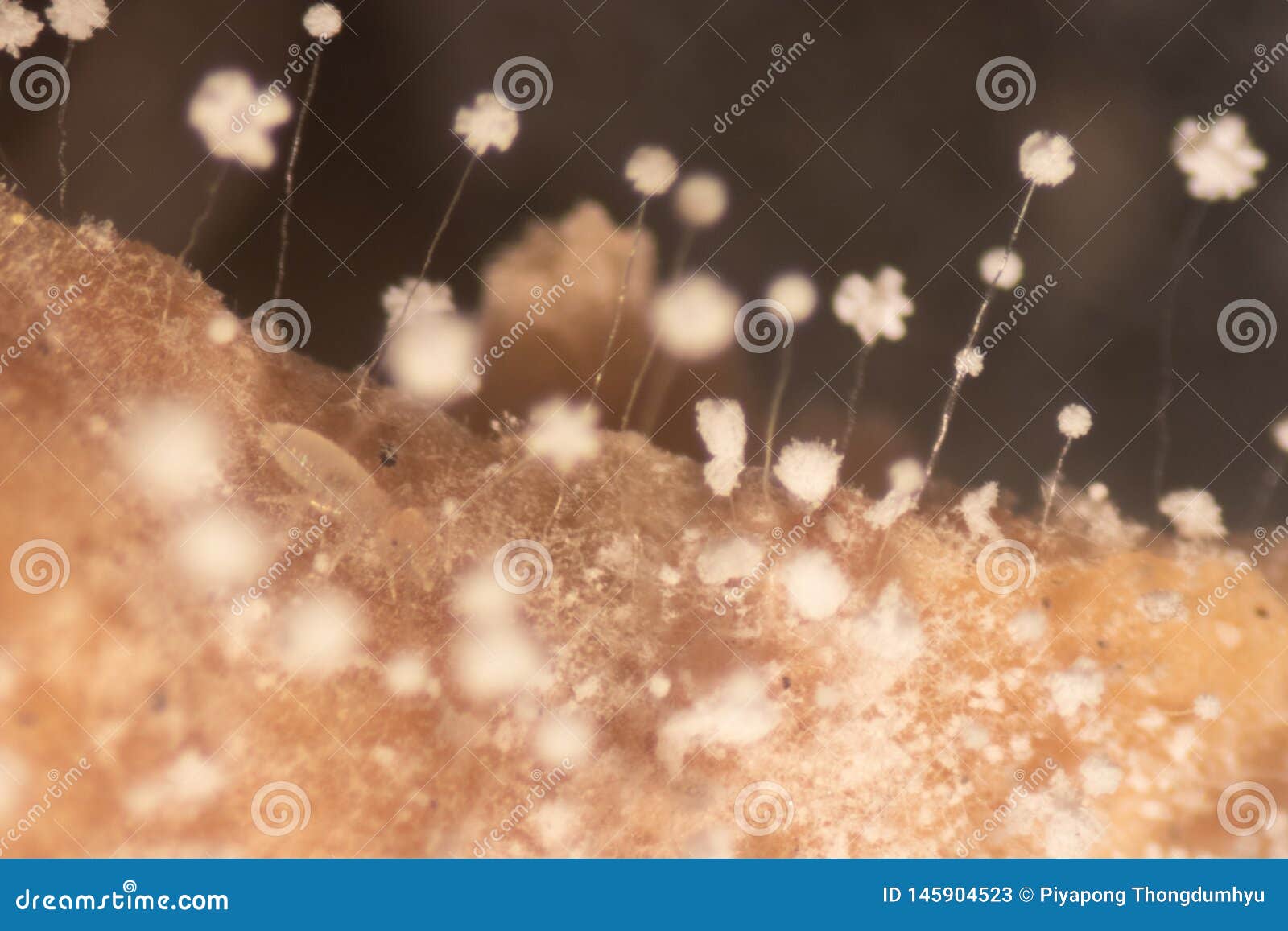 Colony Characteristics of Mold Under the Microscope. Stock Image ...