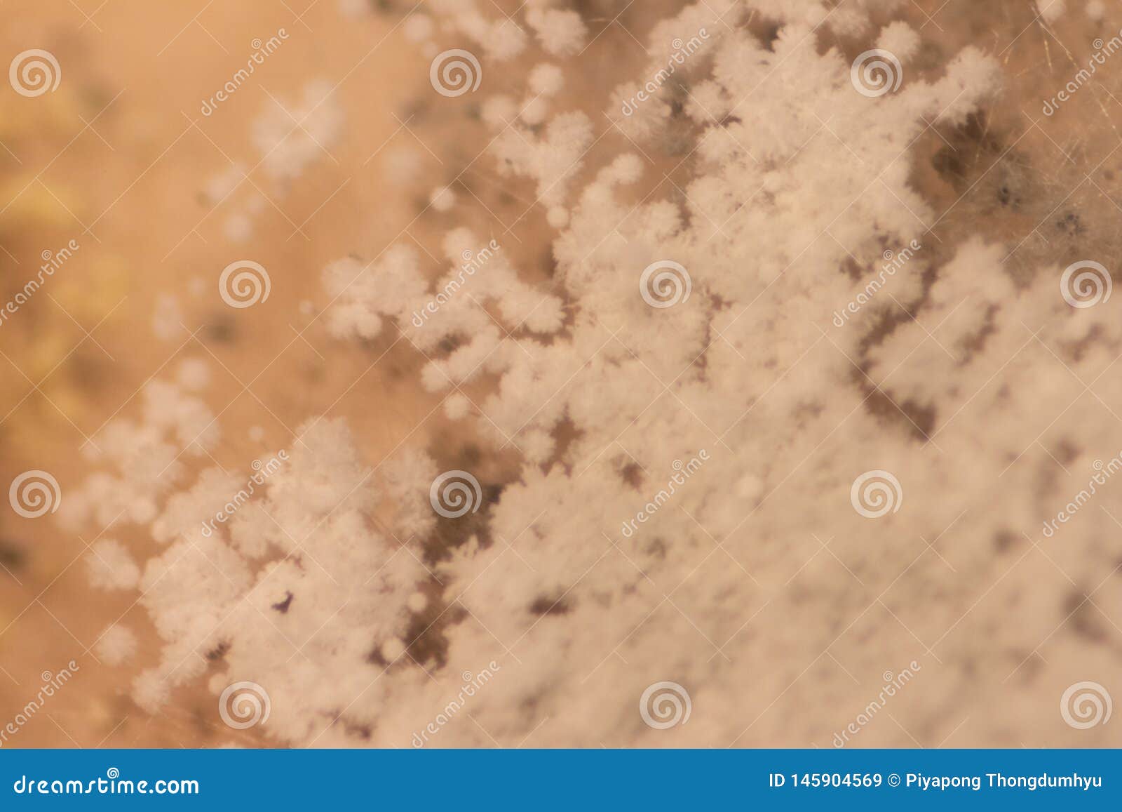 Colony Characteristics of Mold Under the Microscope. Stock Image ...