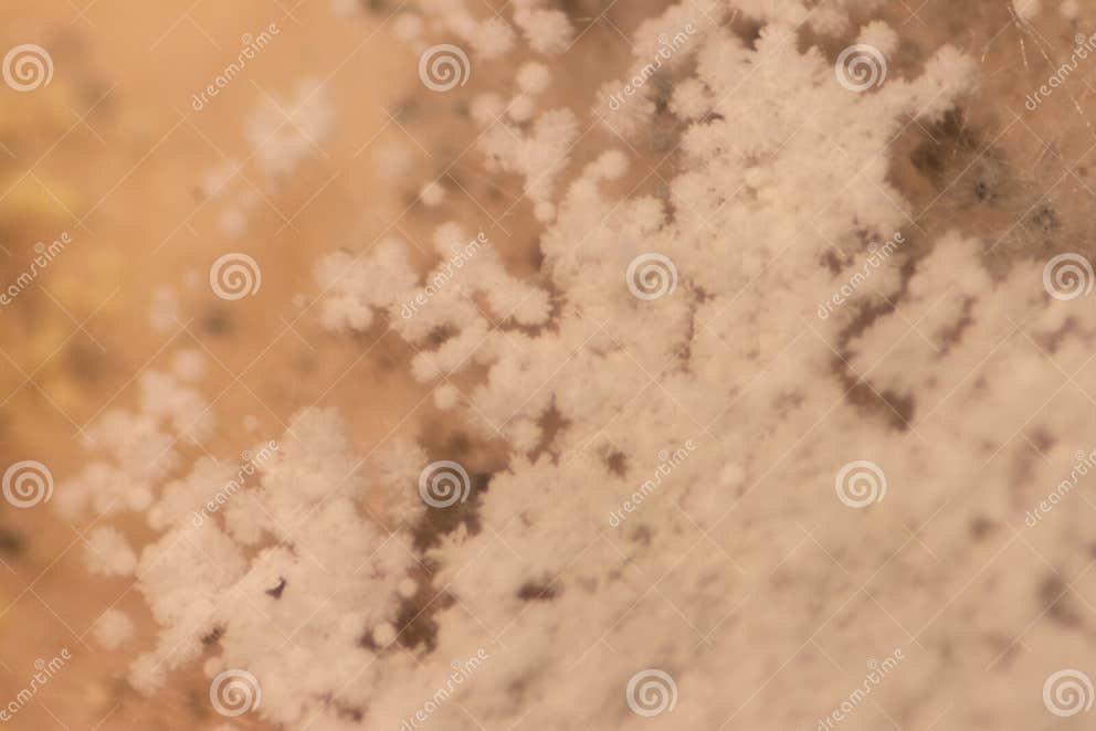 Colony Characteristics of Mold Under the Microscope. Stock Image ...
