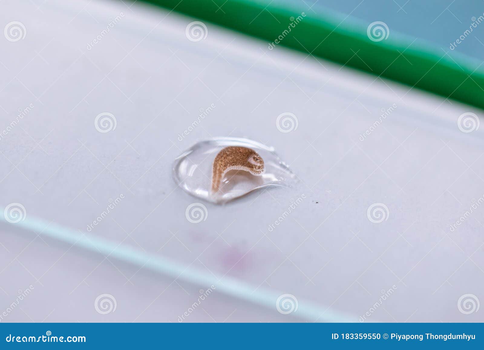 Backgrounds of Parasitic, Study of Parasitic and Anatomical Pathology ...