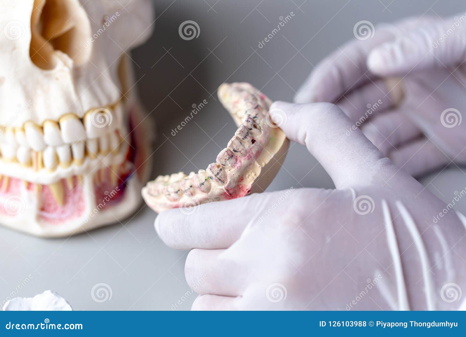 Tooth Model for Education in Laboratory. Stock Photo - Image of implant ...