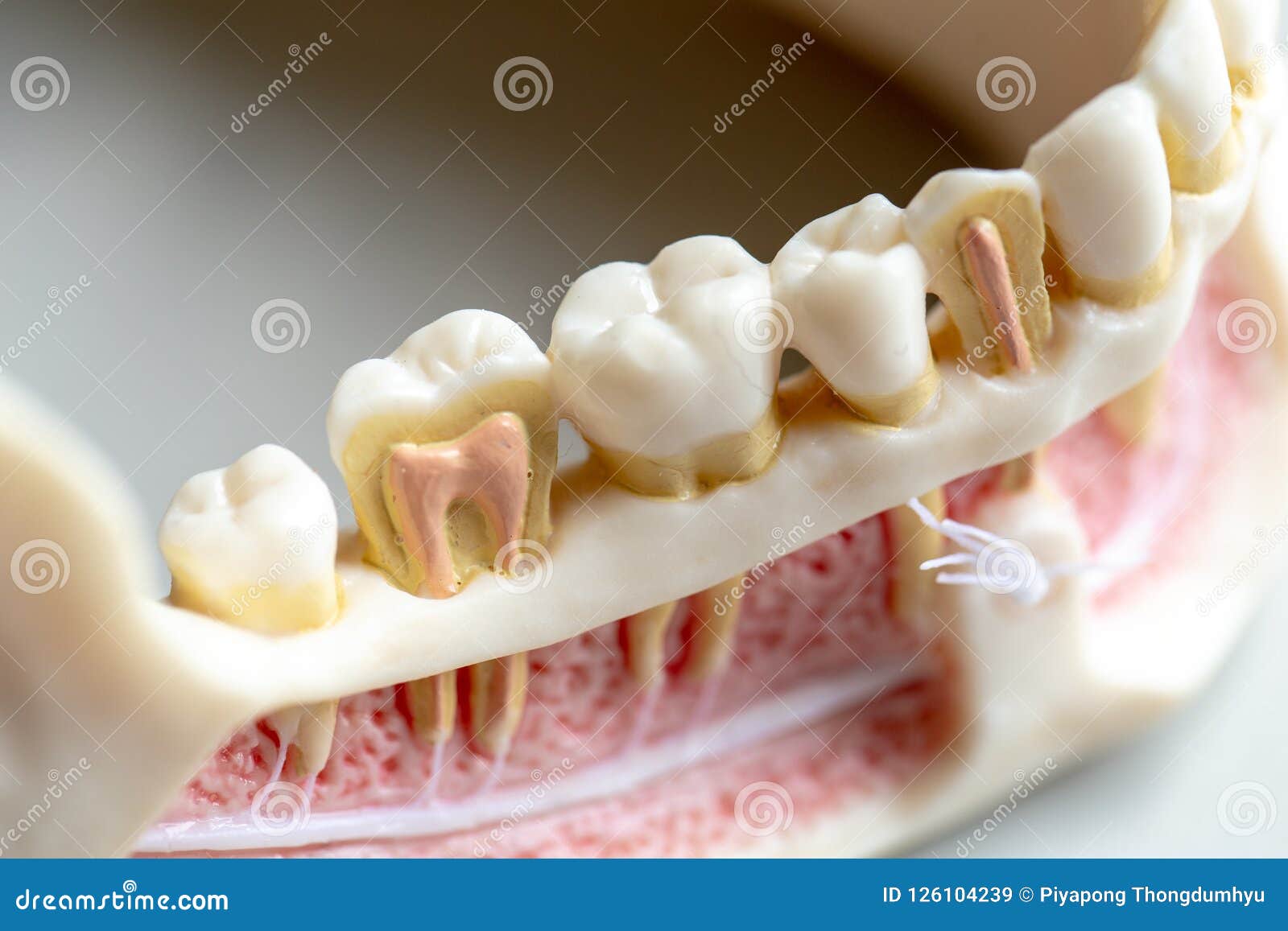 Tooth Model for Education in Laboratory. Stock Image - Image of implant ...