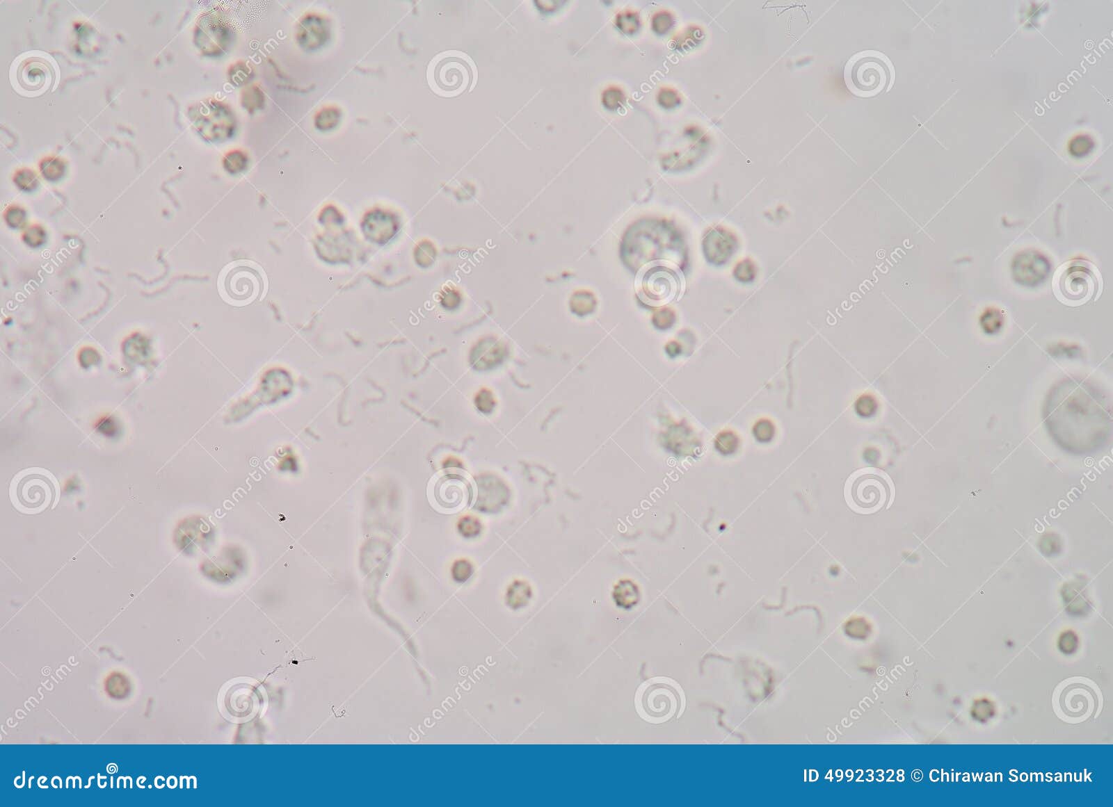 Bactéries en urine photo stock. Image of anormal, santé - 49923328