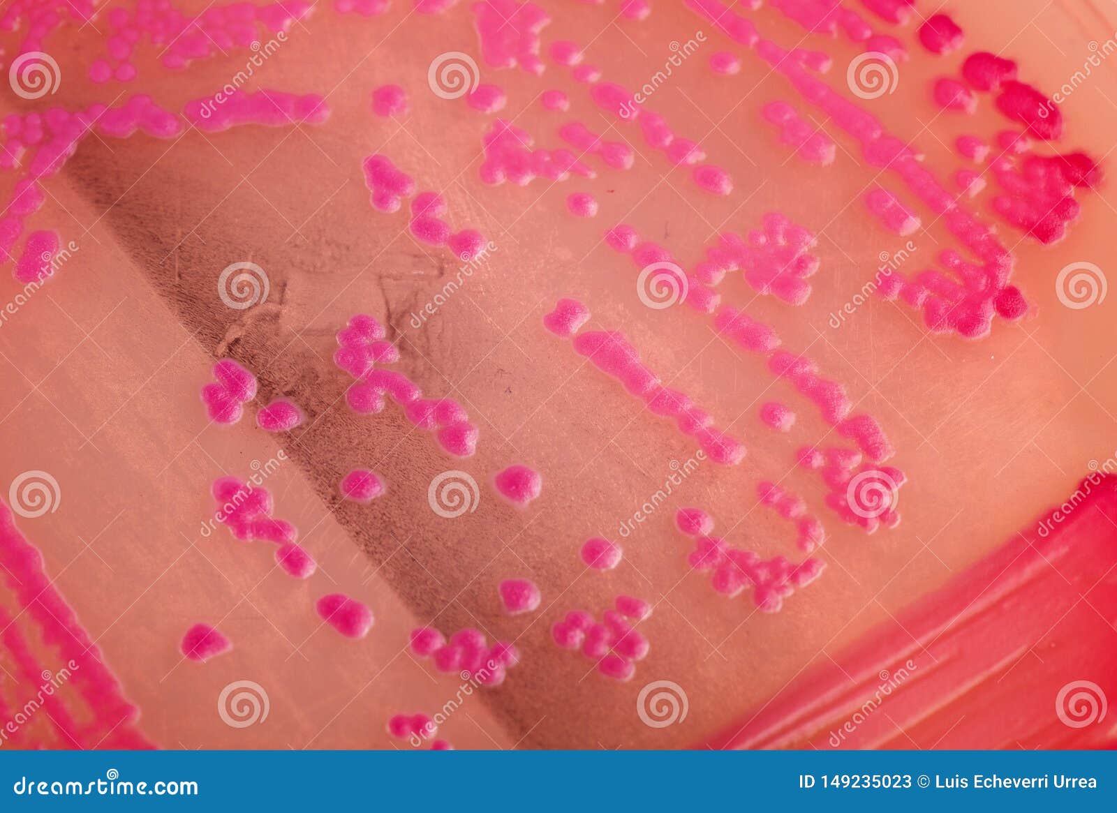 Bact?ries De Pylores De Helicobacter - Vue Sup?rieure Image stock ...