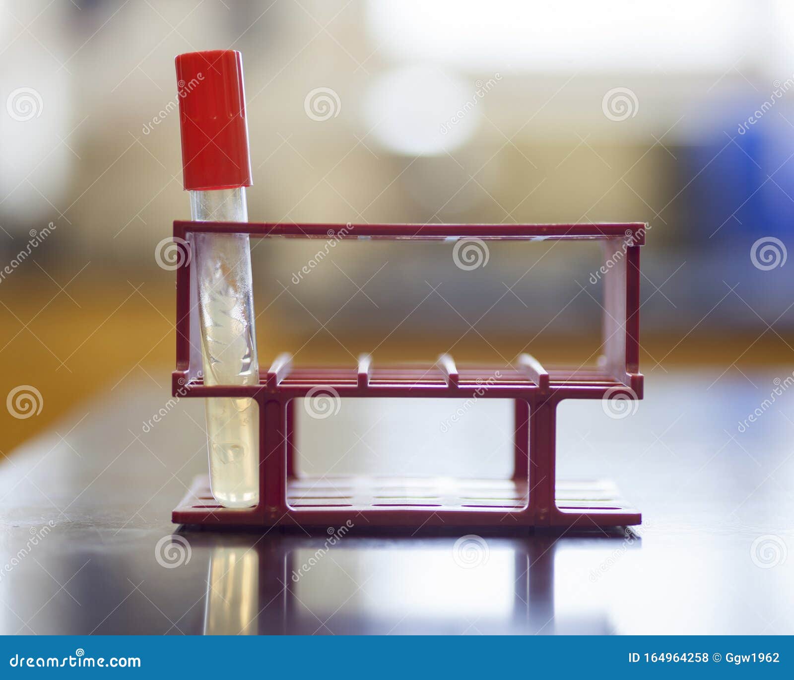 Bacterai Growing on an Agar Slant. Stock Photo - Image of experiment ...
