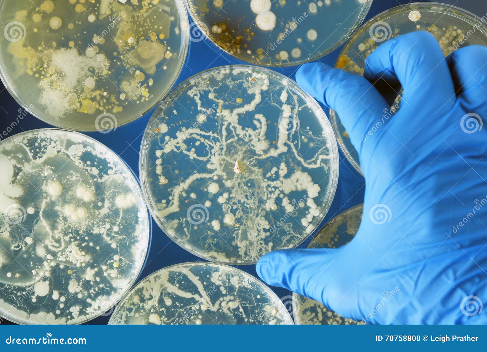 Bacteriën Die in Petrischalen Kweken Stock Foto - Image of kolonies ...