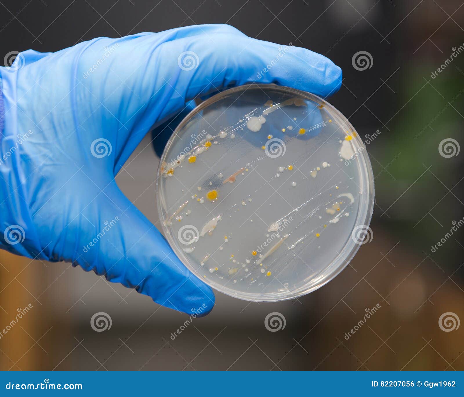 Bacteriën Op Een Agar-agarplaat Stock Foto - Image of organisme ...