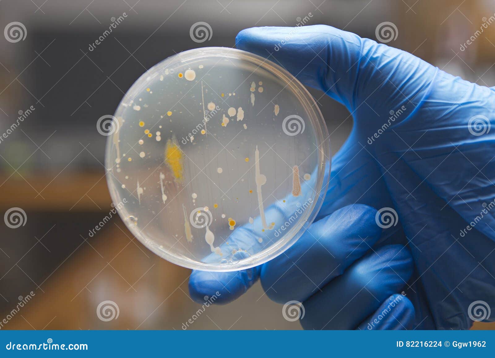 Bacteria on an agar plate stock photo. Image of analysis - 82216224