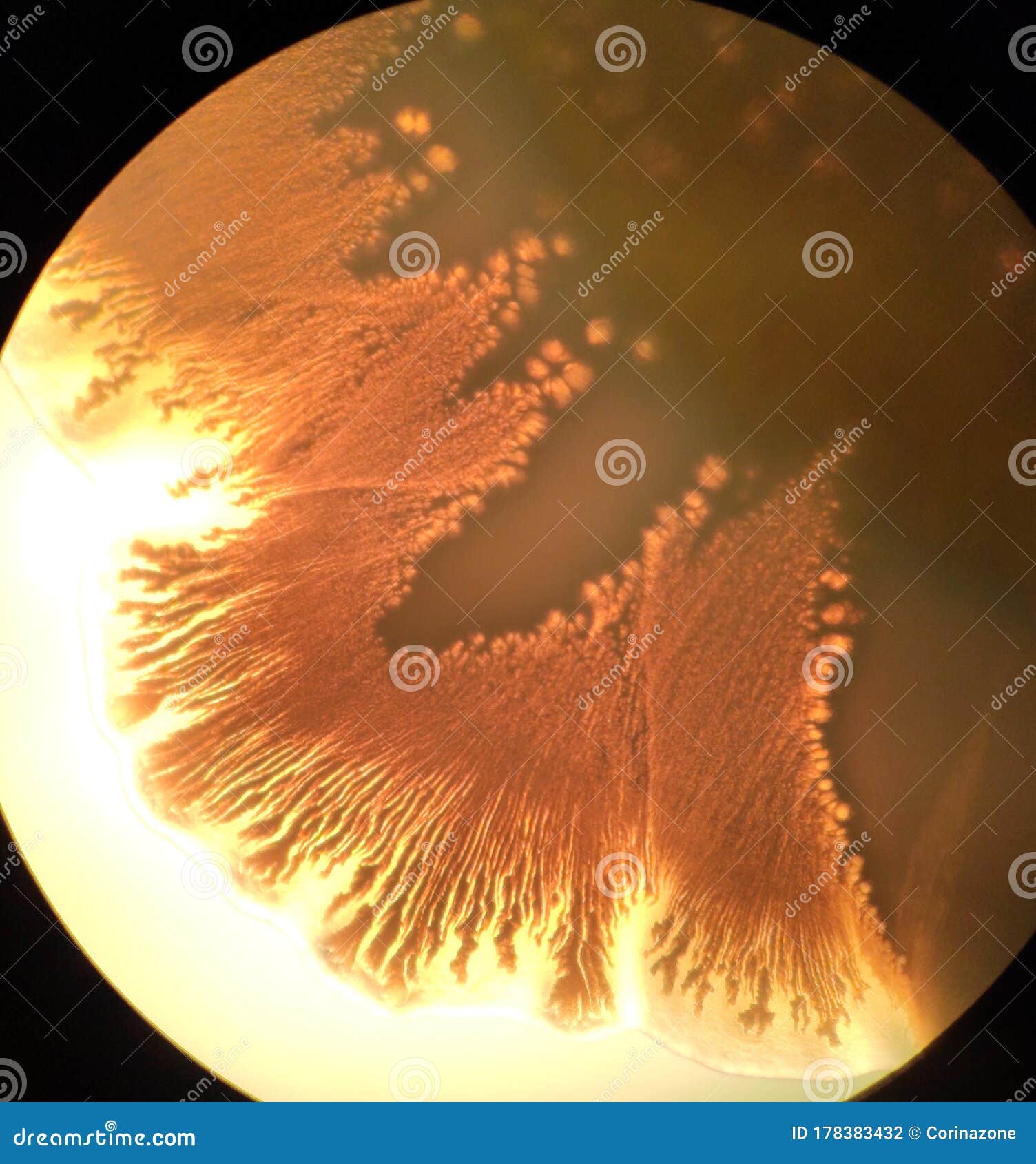 When the Bacteria is the Artist - Beuatiful Branched Bacterial Growth ...