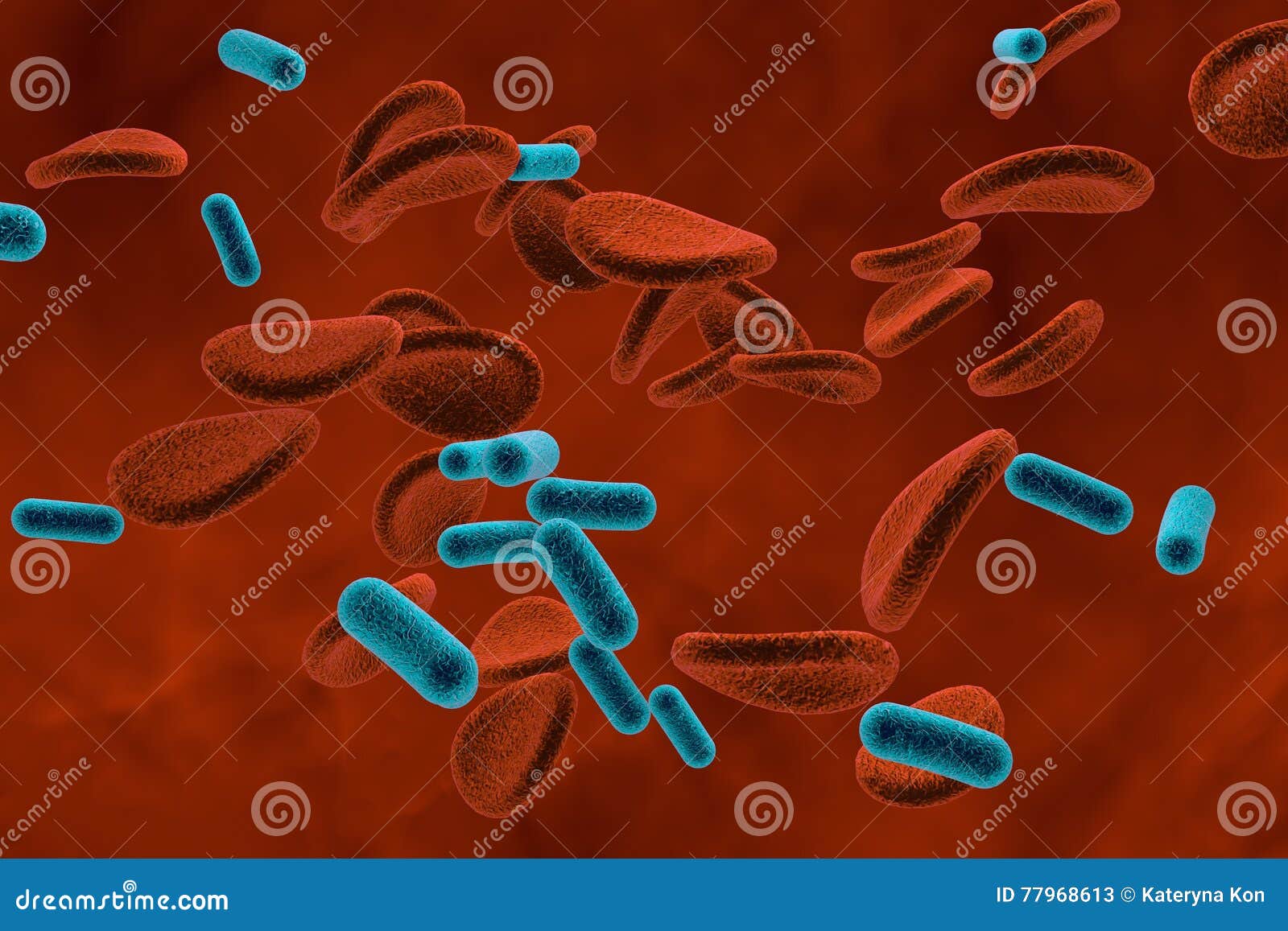 Bacteria in Blood, Bacteriemia Stock Illustration - Illustration of ...