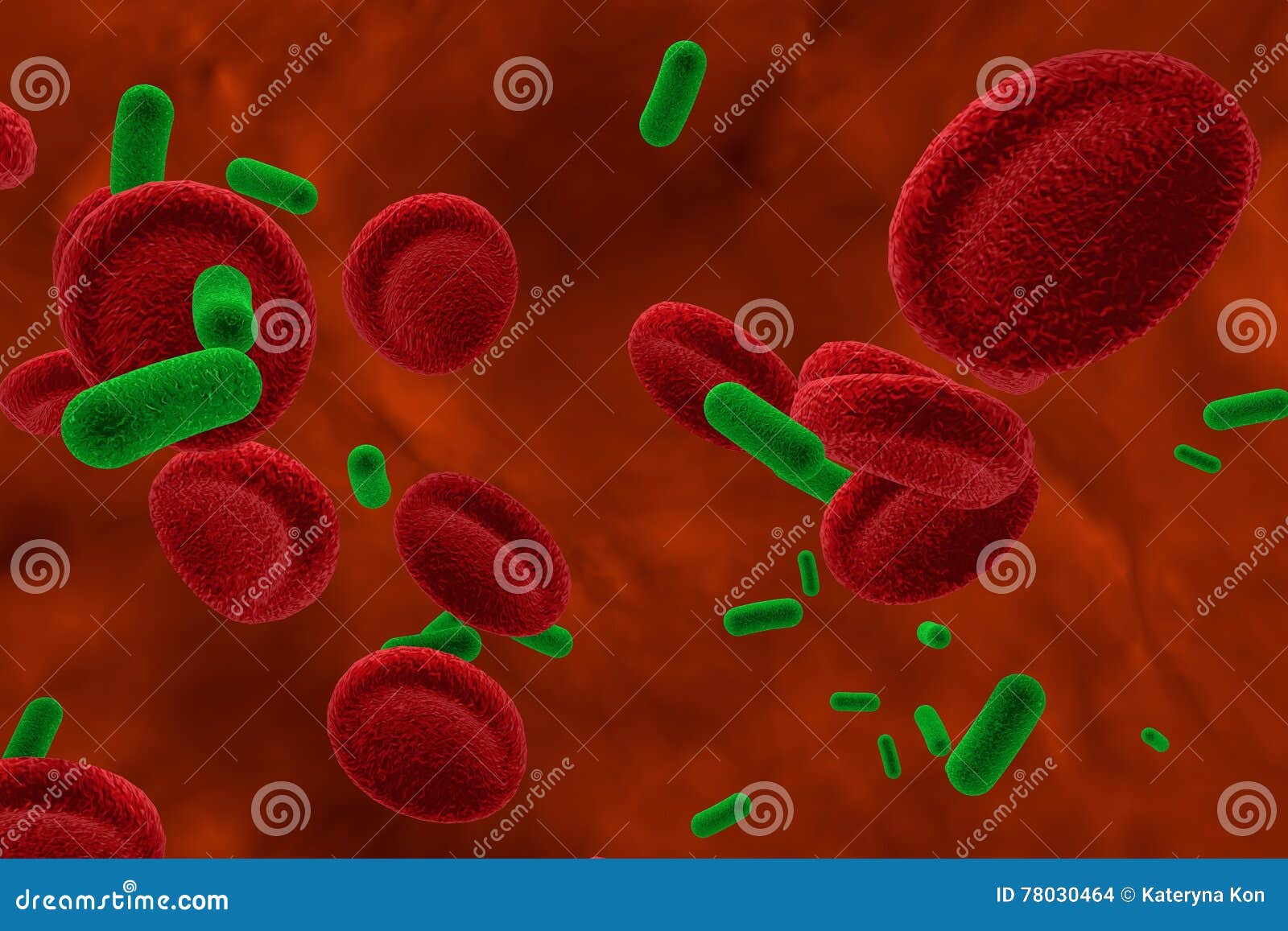 Bacteria in Blood, Bacteriemia Stock Illustration - Illustration of ...
