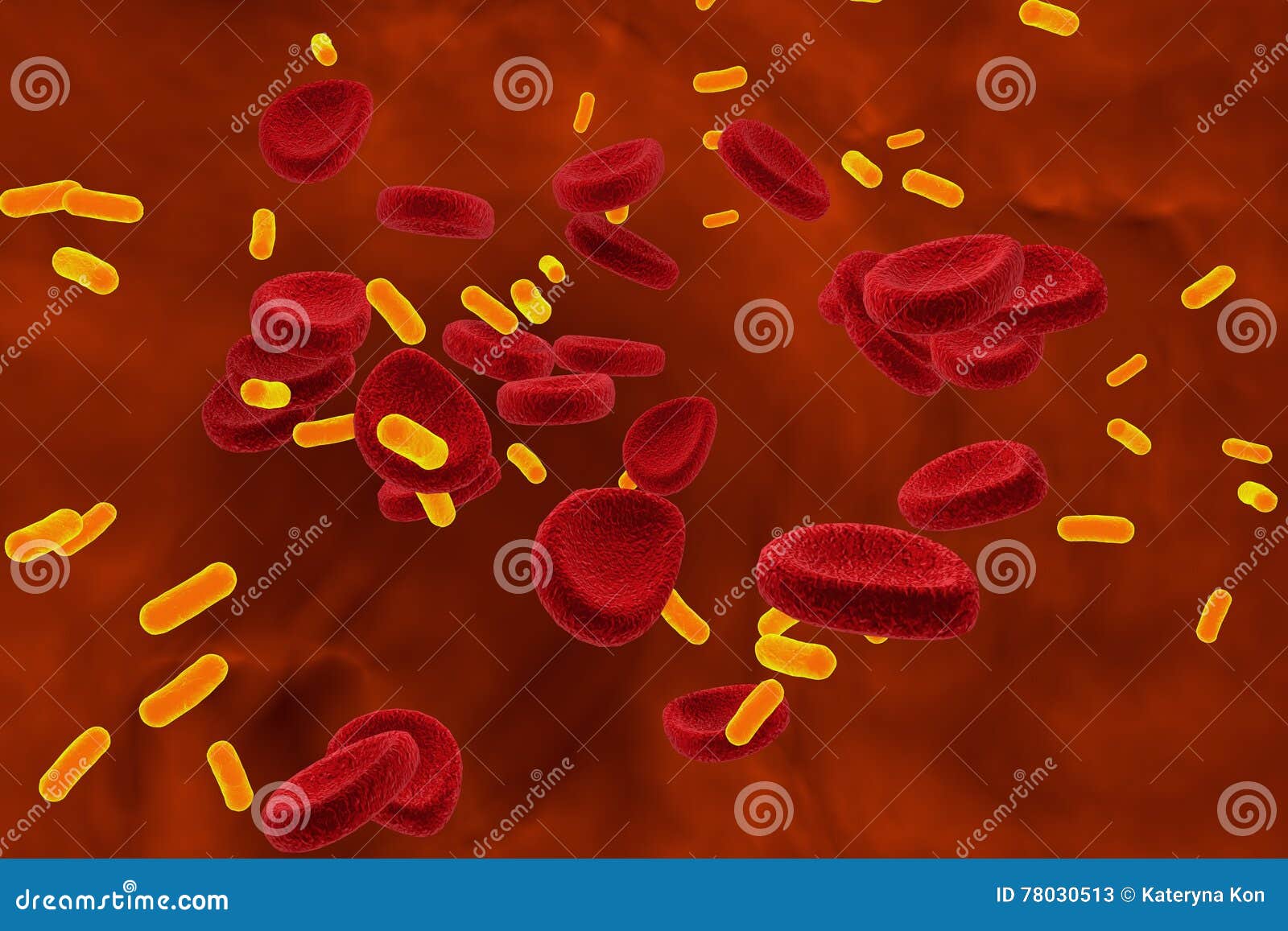 Bacteria in Blood, Bacteriemia Stock Illustration - Illustration of ...
