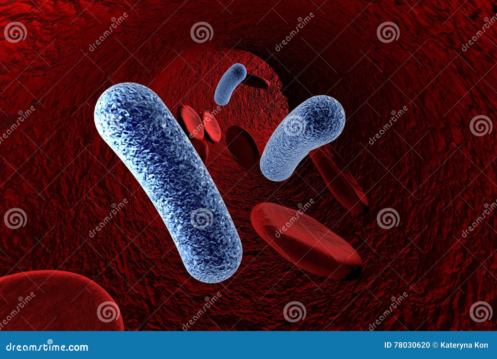 Bacteria in Blood, Bacteriemia Stock Illustration - Illustration of ...