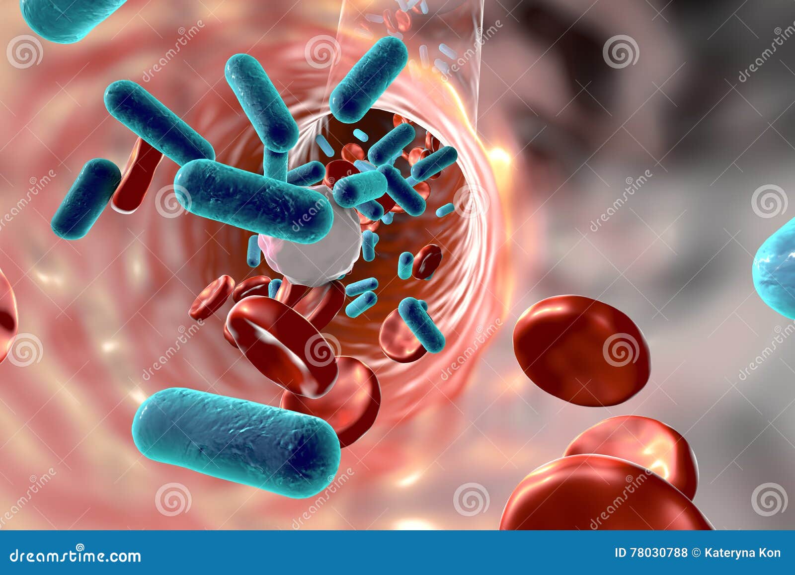 Bacteria in Blood, Bacteriemia Stock Illustration - Illustration of ...