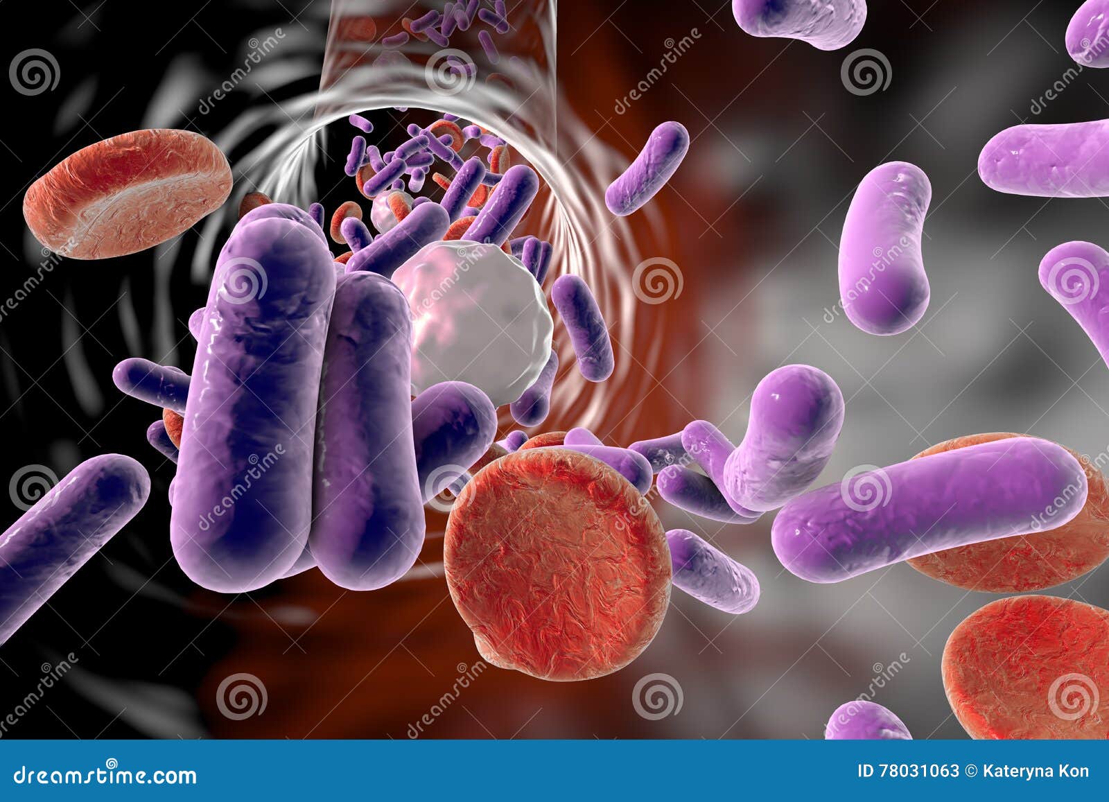 Bacteria in Blood, Bacteriemia Stock Illustration - Illustration of ...