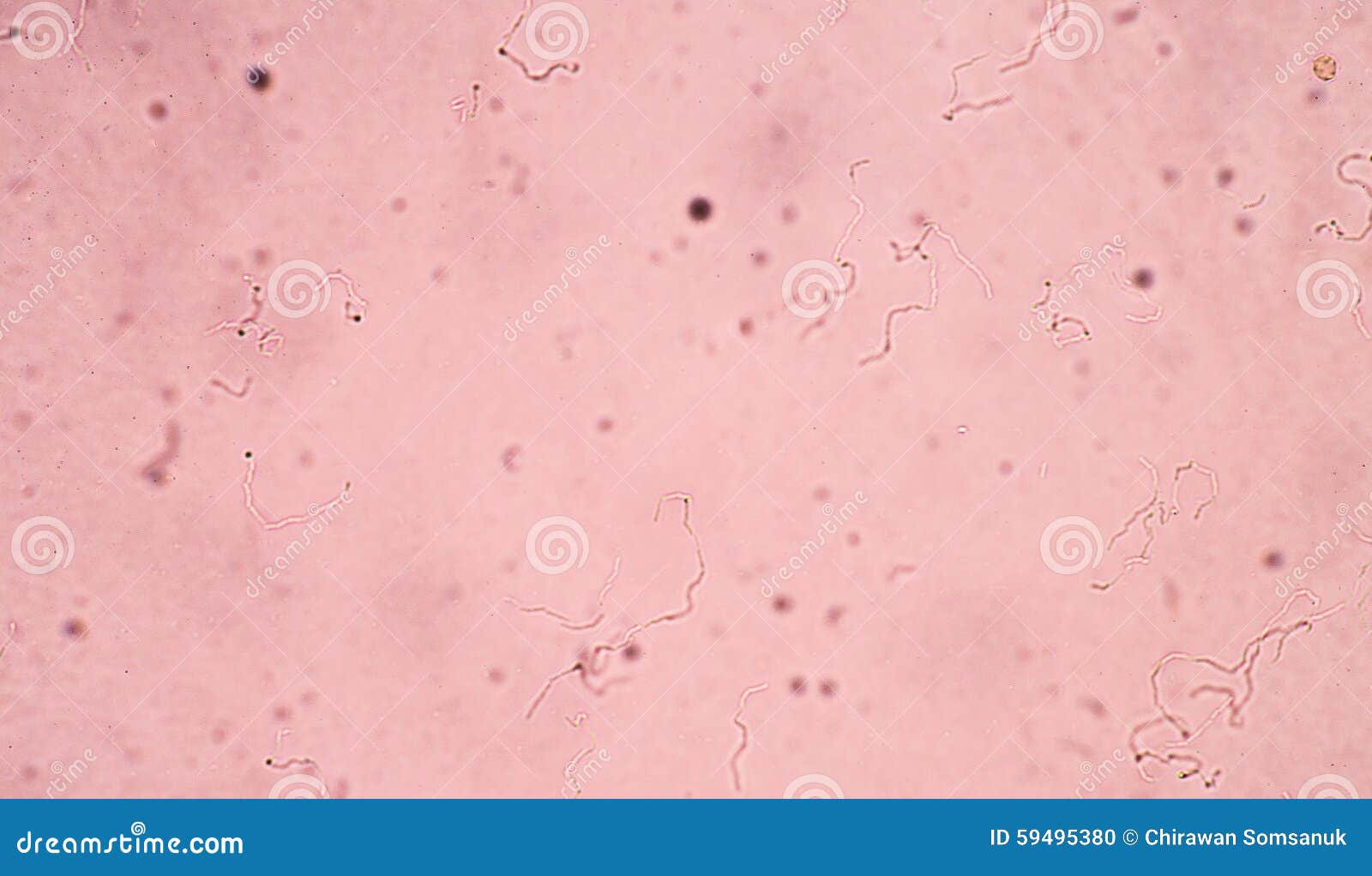 Bacteria stock photo. Image of membrane, flagella, bacterium - 59495380