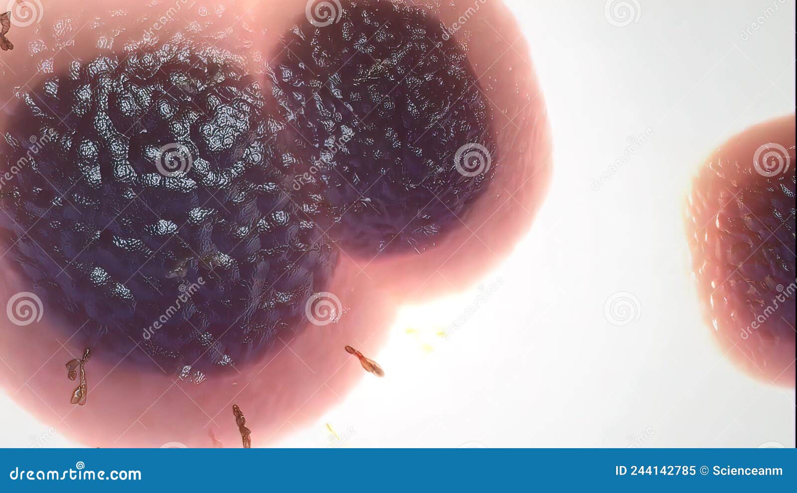 Bacteria Cell Destruction 3D Illustration Stock Illustration ...