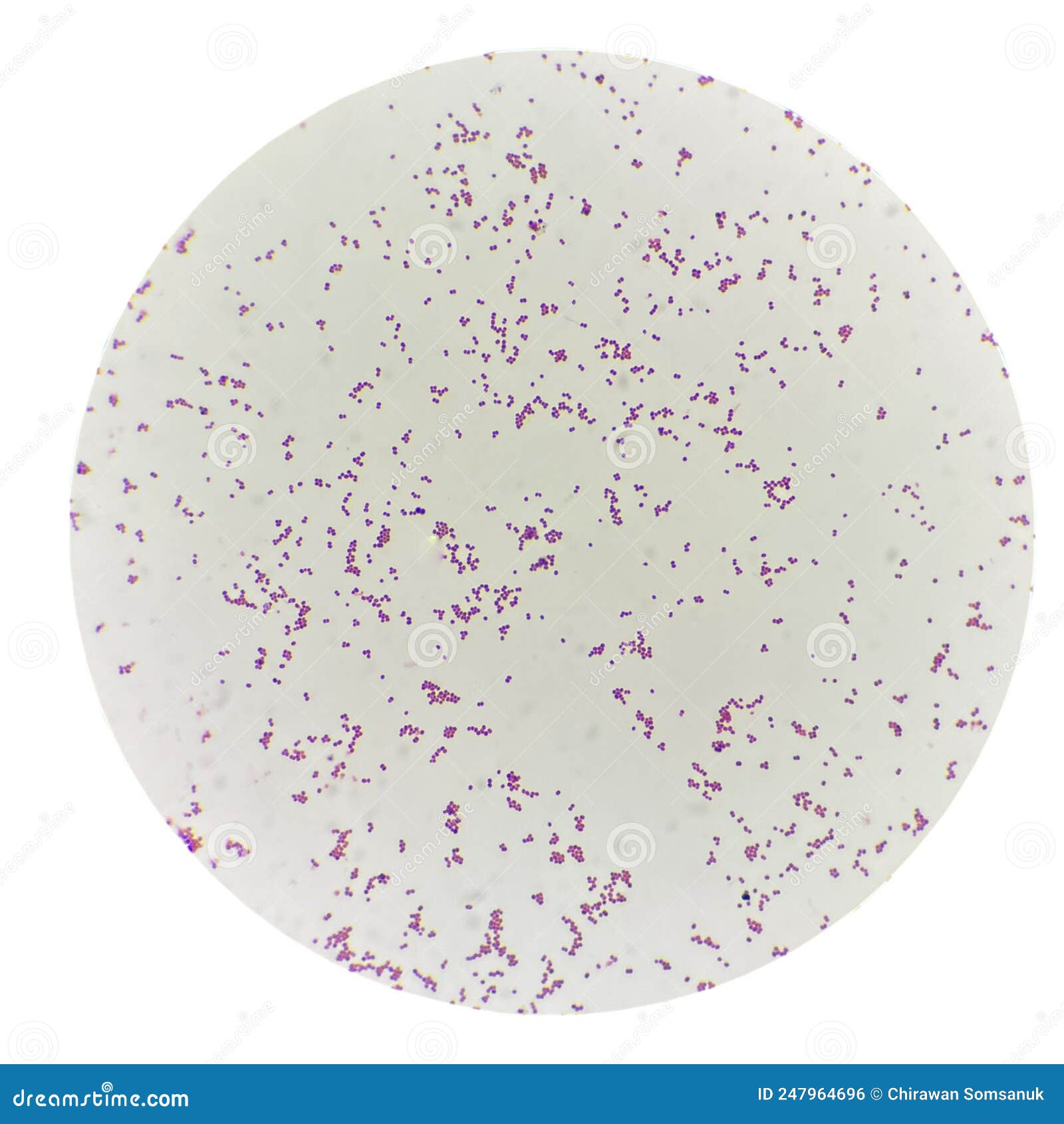 Bacteria Cell Finding with Microscope Stock Photo - Image of health ...