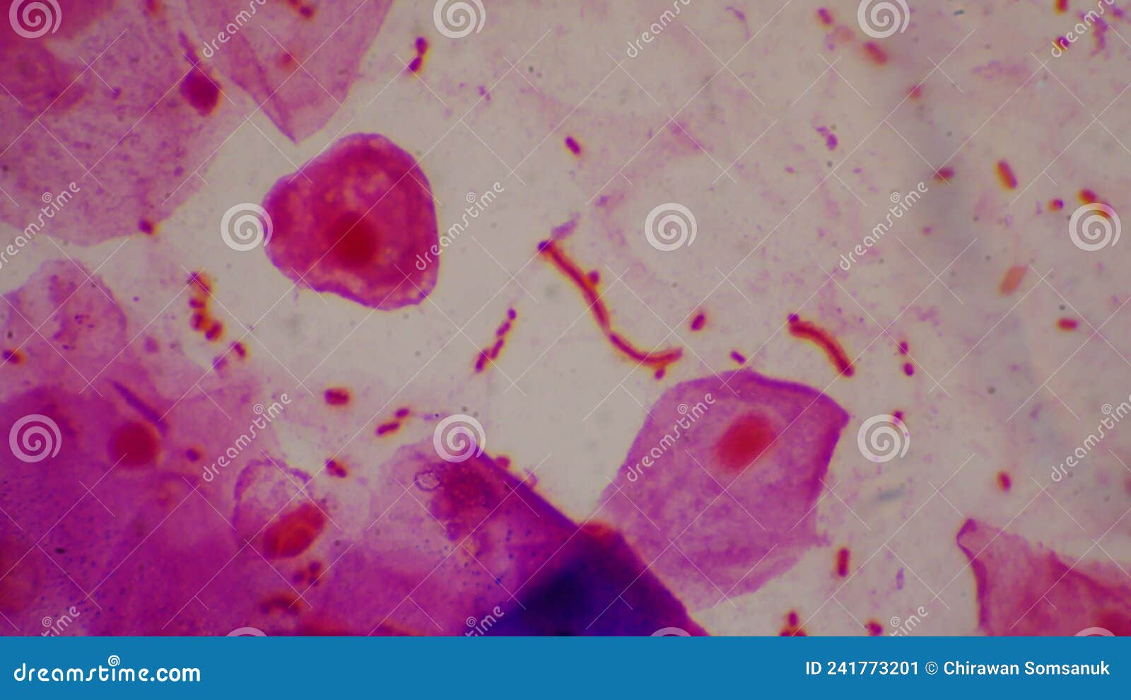 Bacteria Cell Gram Neagative Bacilli with Capsule Pathogen.Sample ...