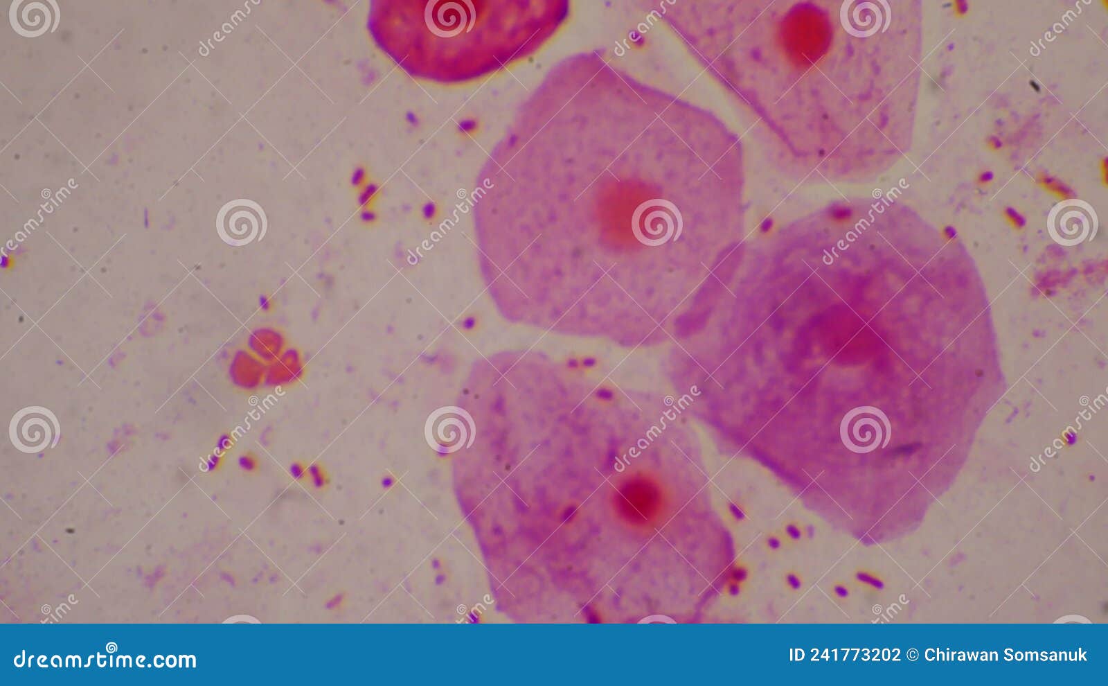 Bacteria Cell Gram Neagative Bacilli with Capsule Pathogen.Sample ...