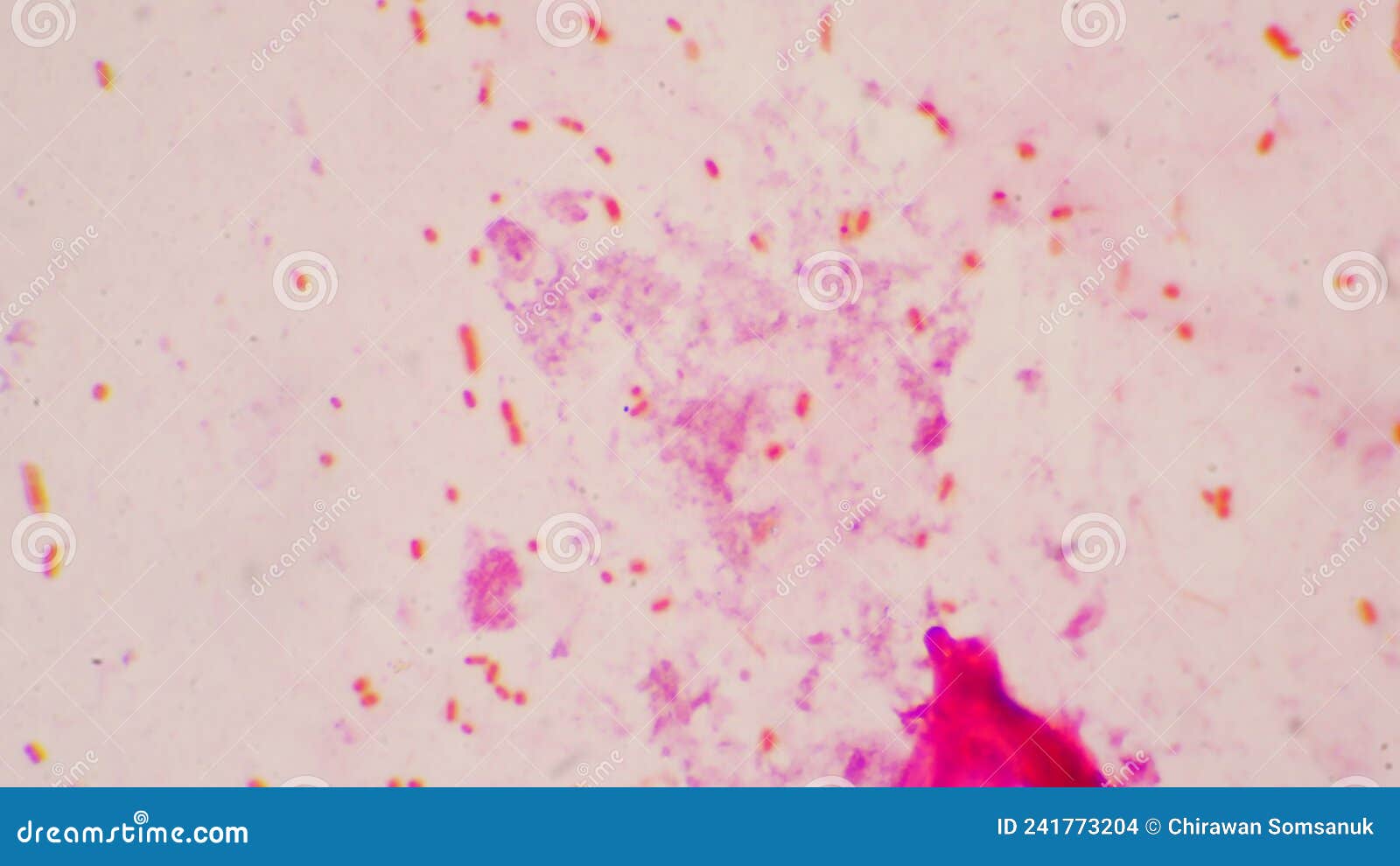 Bacteria Cell Gram Neagative Bacilli With Capsule Pathogen.Sample ...