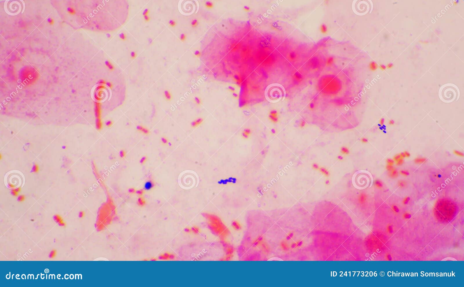 Bacteria Cell Gram Neagative Bacilli With Capsule Pathogen.Sample ...