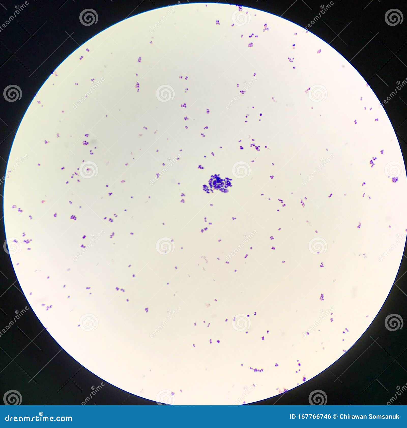 Bacteria Cell Gram Positive Cocci Stock Photo - Image of medicine ...