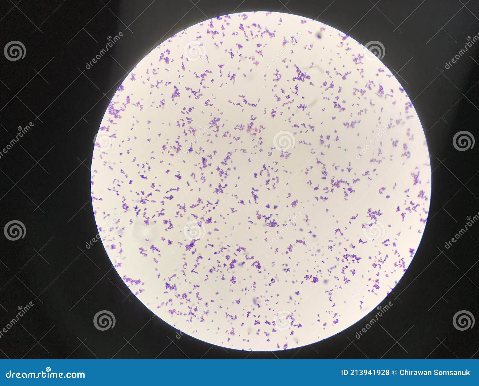 Bacteria Cell Under Microscope Stock Image | CartoonDealer.com #95222725