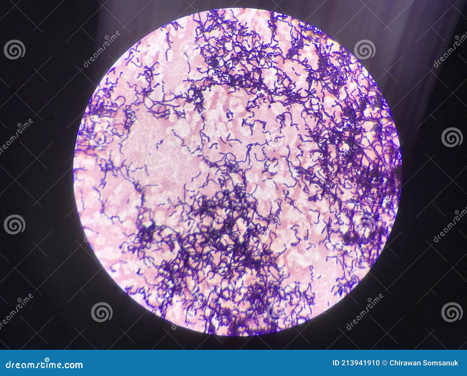 Bacteria Cell in Gram Stain Testing. Stock Photo - Image of healthy ...