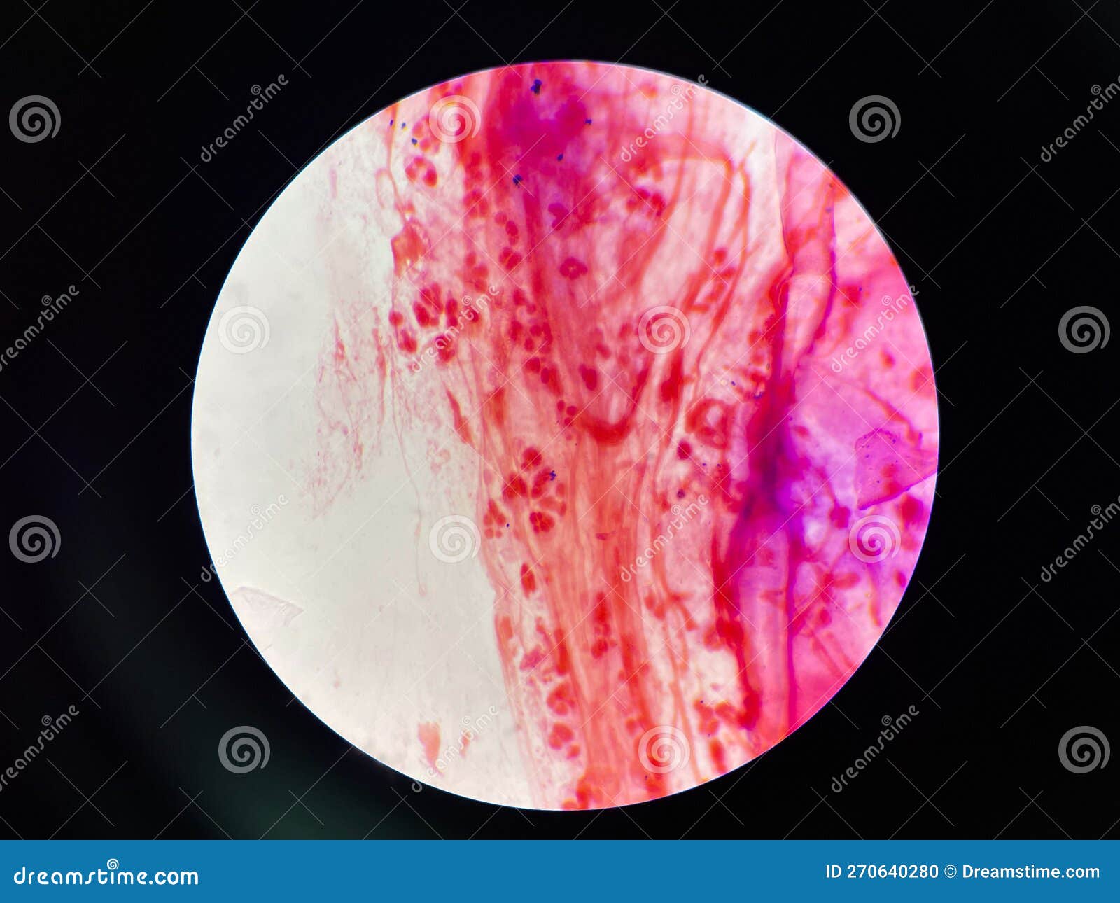 Gram Stain Test Showing Bacteria Cells. Royalty-Free Stock Photo ...