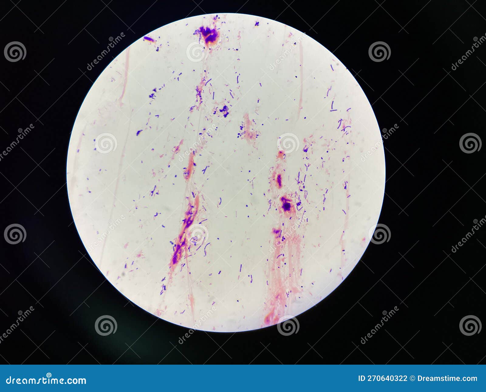 Gram Stain Test Showing Bacteria Cells. Stock Photo | CartoonDealer.com ...
