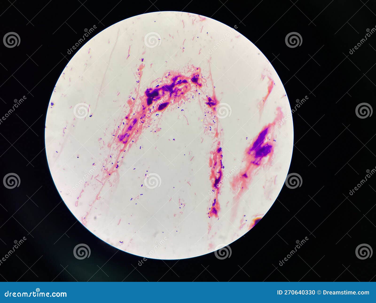 Bacteria Cell in Sputum Sample Gram Stain Method Stock Photo - Image of ...