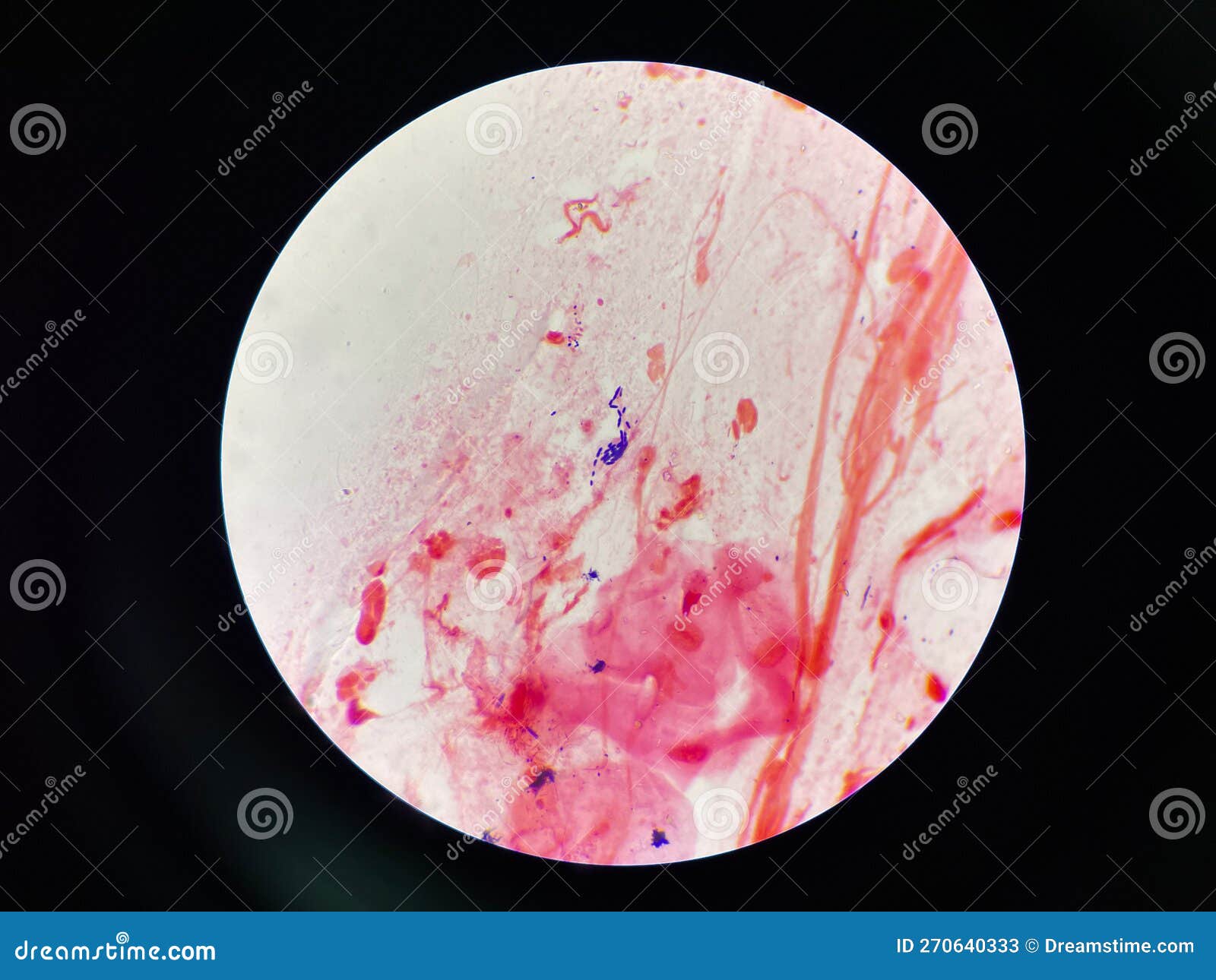 Gram Stain Test Showing Bacteria Cells. Stock Photo | CartoonDealer.com ...