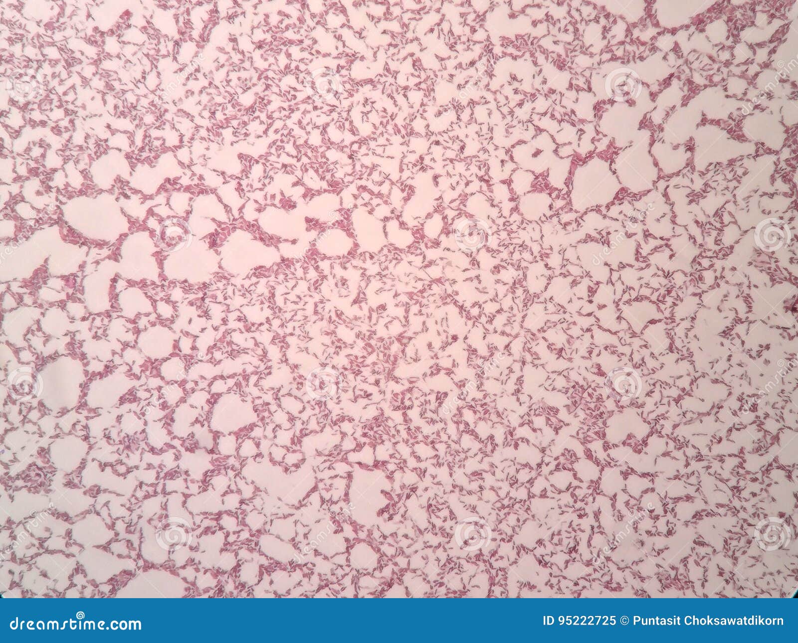Bacteria Cell In Sputum Sample Gram Stain Method Royalty Free Stock Image