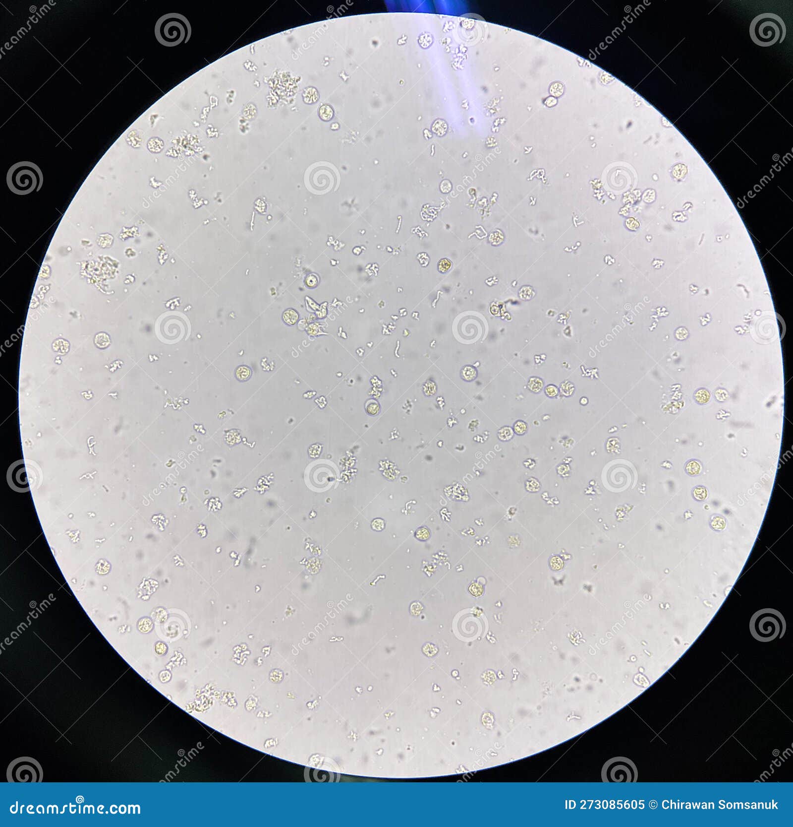 Bacteria Cell In Urine With White Blood Cell Stock Photo ...