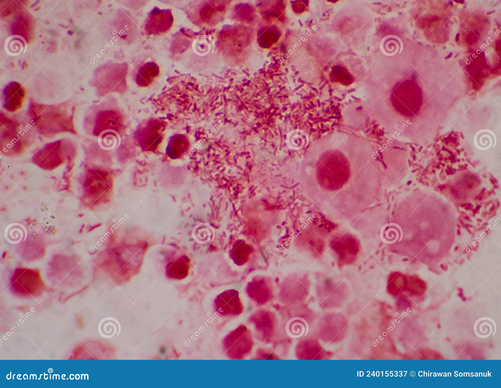 Bacteria Cell with White Blood Cells Stock Image - Image of citrobacter ...