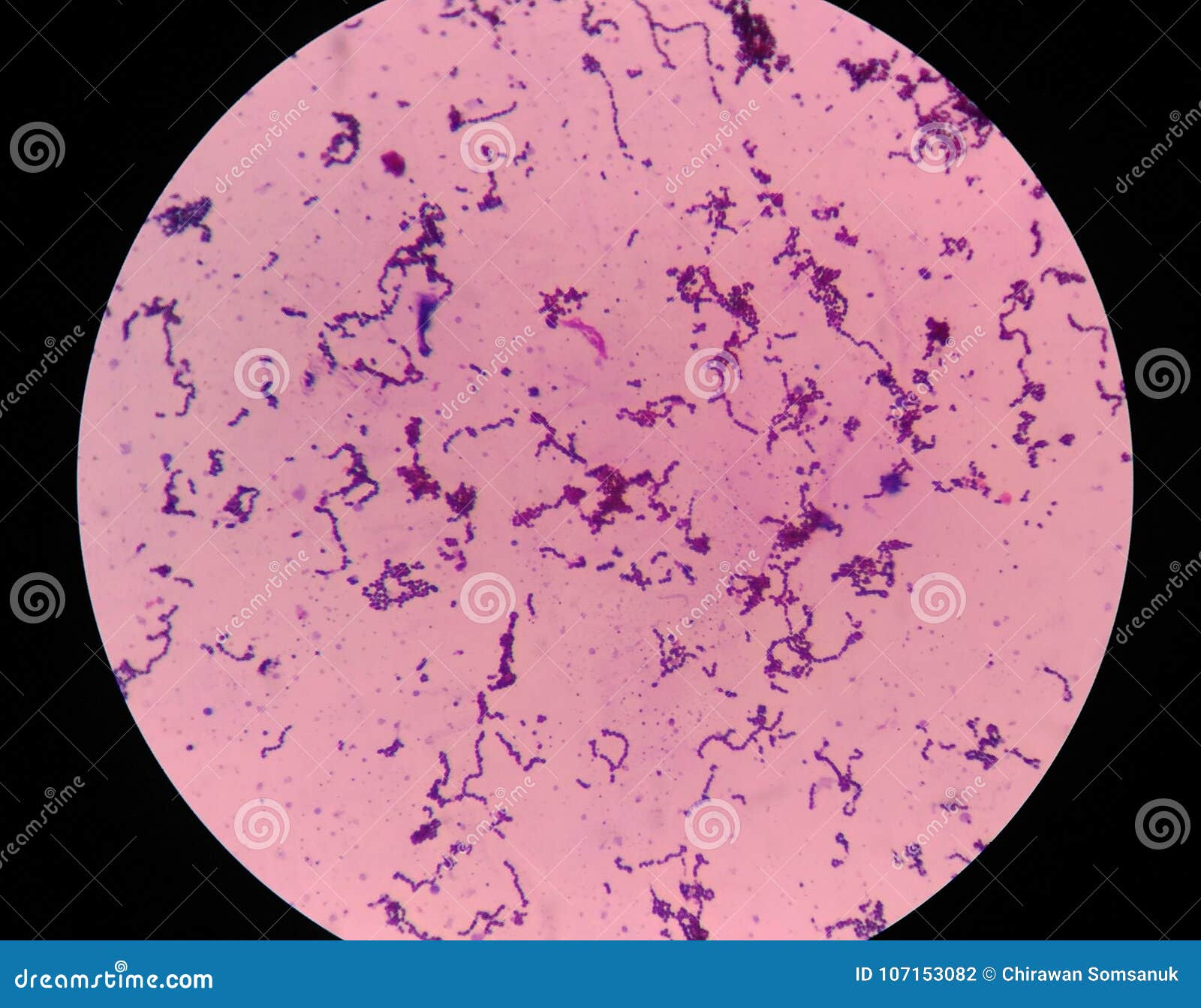 Bacteria Cells Finding with Microscope. Stock Photo - Image of ...