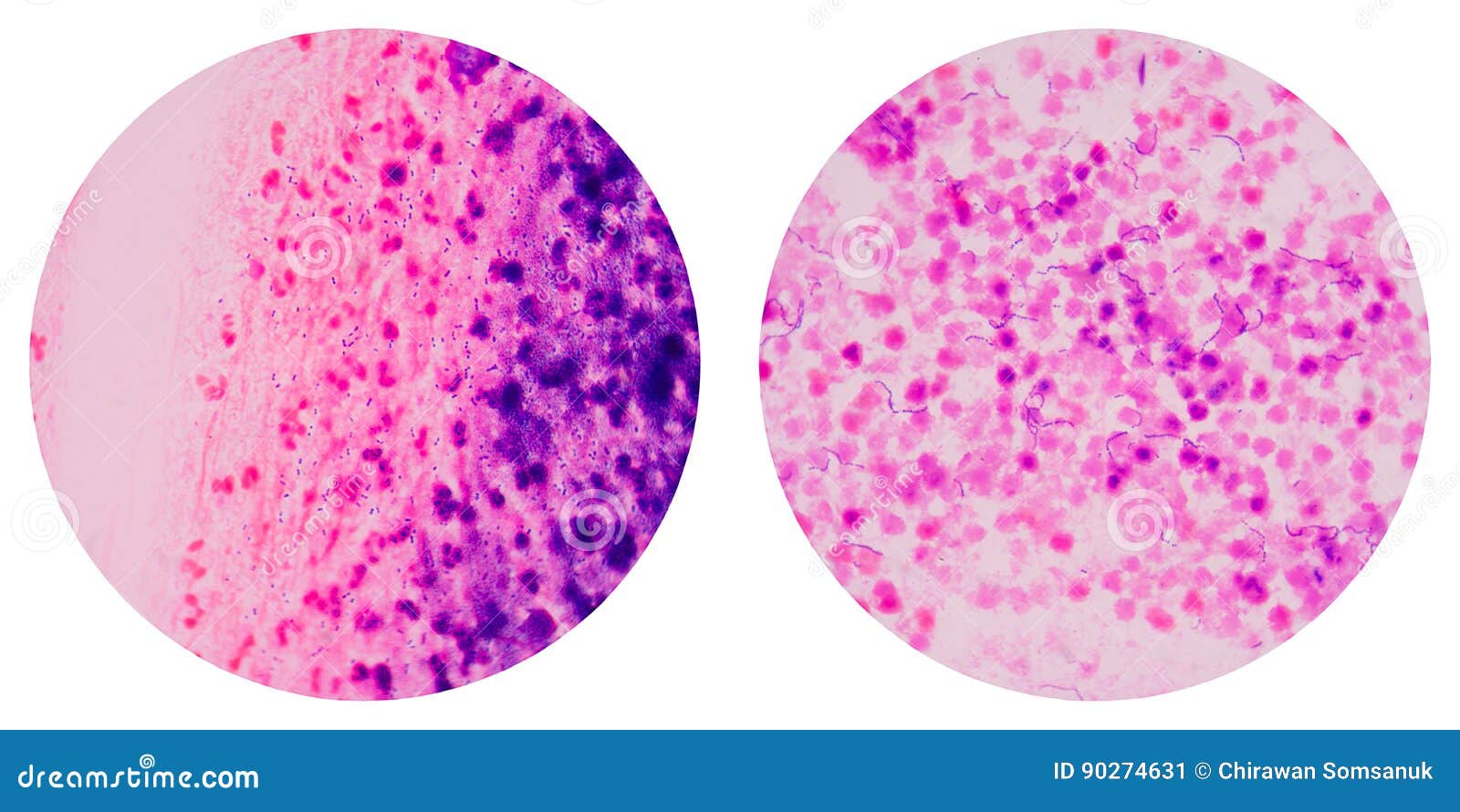 Bacteria cells on Gram stock image. Image of health, medicine - 90274631