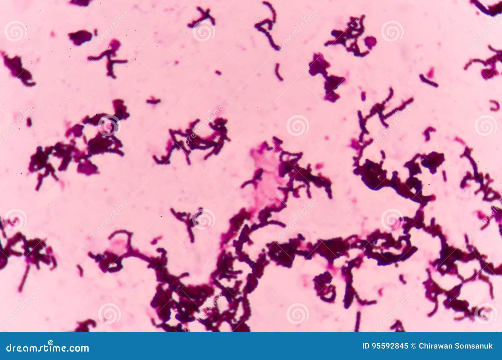 Gram Stain Test Showing Bacteria Cells. Royalty-Free Stock Photo ...