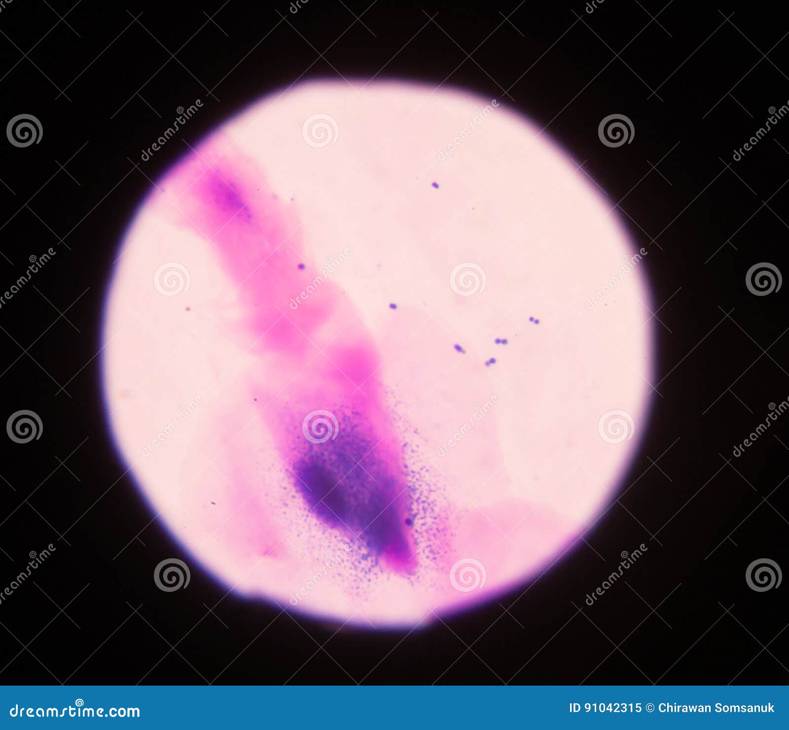 Bacteria Cells on Gram Stain Stock Image - Image of blue, negative ...