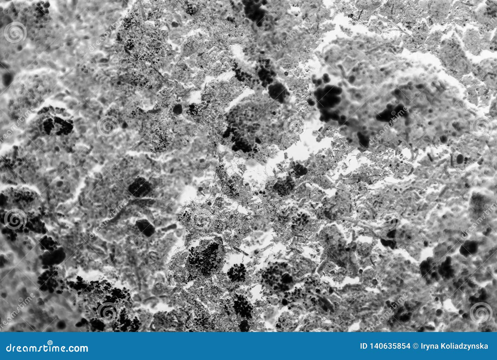 Bacteria or Cells Under a Microscope. Multiplication of Bacteria or ...