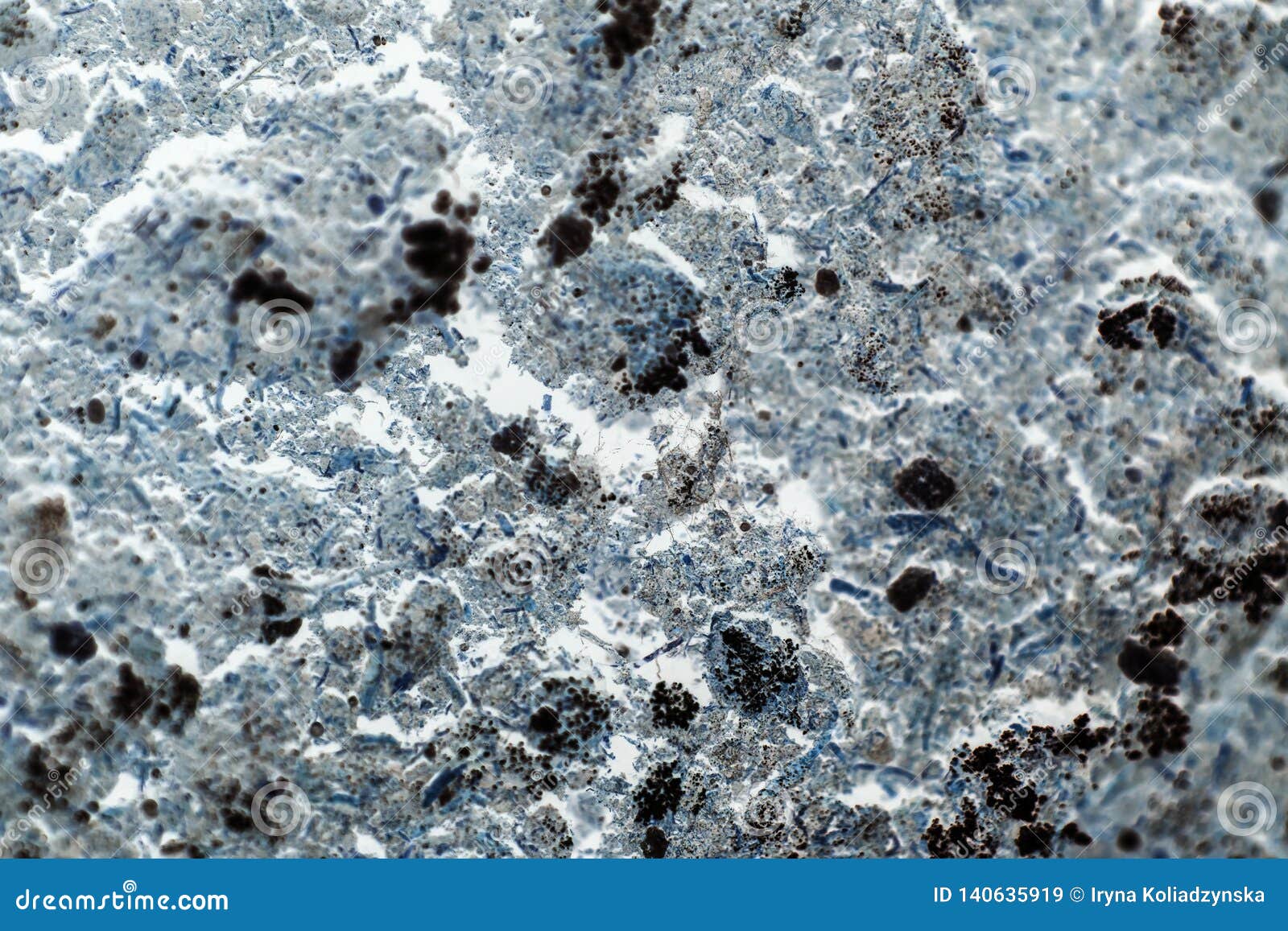 Bacteria or Cells Under a Microscope. Multiplication of Bacteria or ...